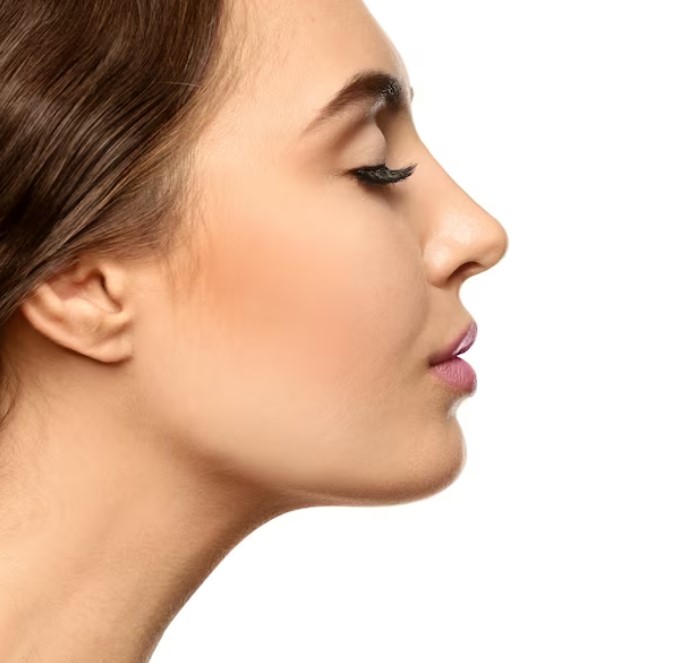 Mentón - Doctora Francine Bravo